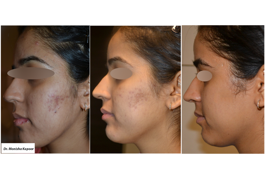 Skin Clinic in Delhi | Skin Specialists, Skin Treatment in India